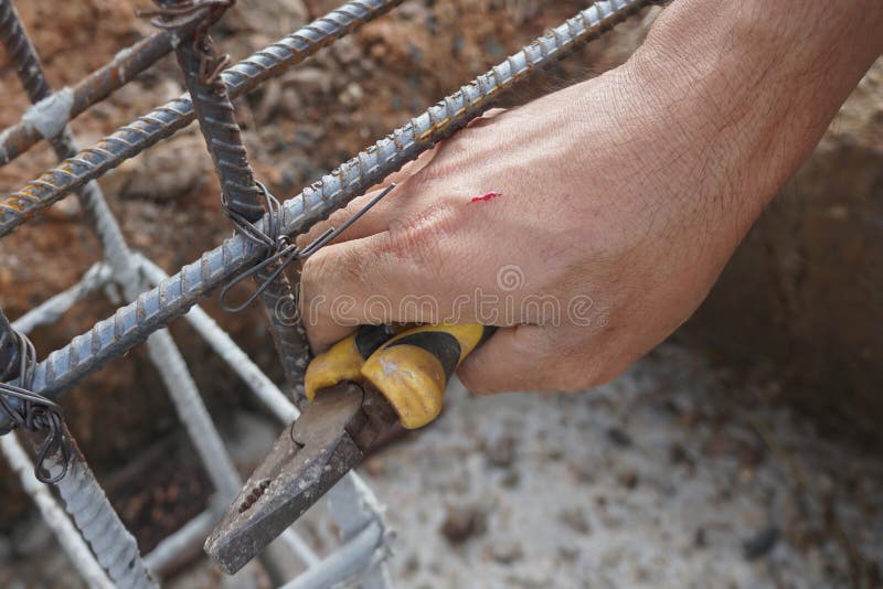 The Back of the Hand Was a Fresh Wound and Bleeding Caused by a Steel ...