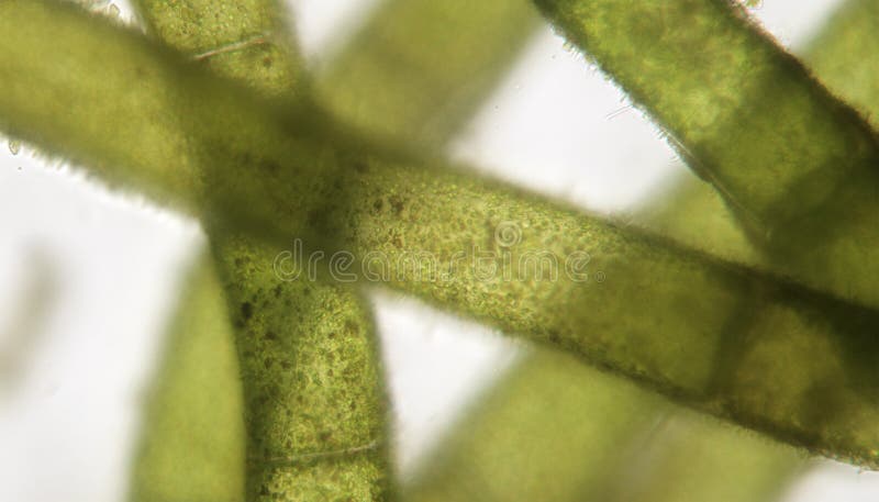 Cyanobacteria Unicellulaire De Microcystis D'algues Au Microscope Cause ...