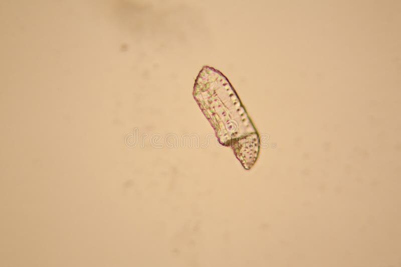 Accumulez Le Plancton Et Les Algues De L'eau Au Microscope Image stock ...