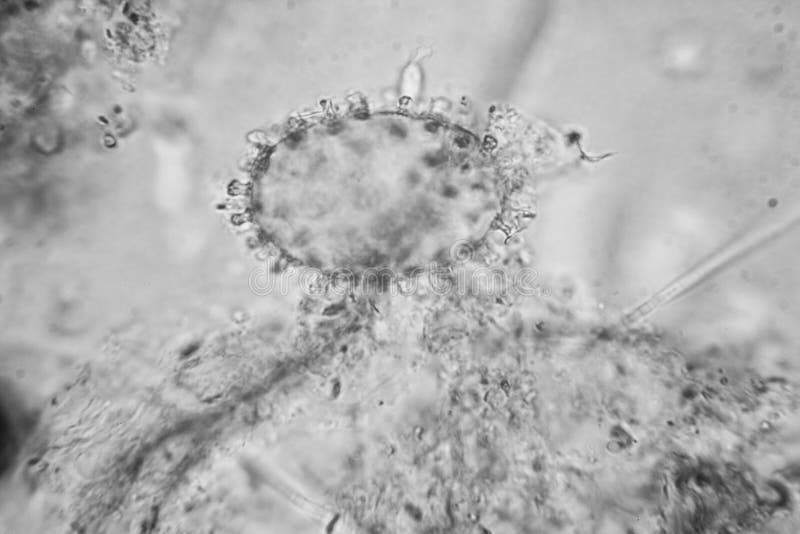 Accumulez Le Plancton Et Les Algues De L'eau Au Microscope Image stock ...