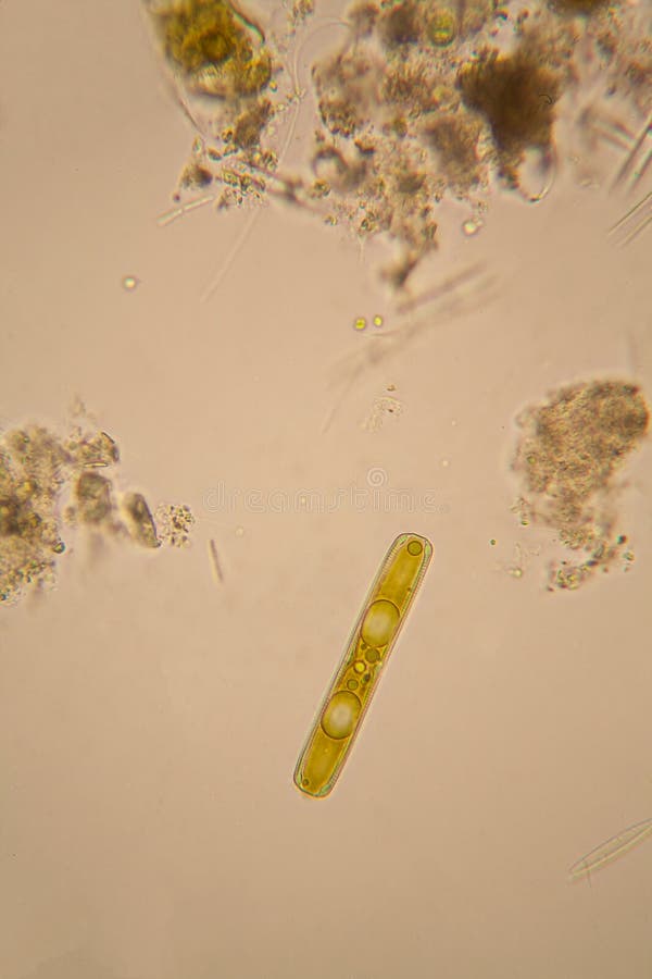 Accumulez Le Plancton Et Les Algues De L'eau Au Microscope Diatomées ...