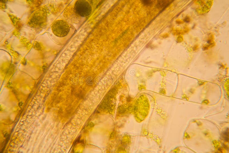 Accumulez Le Plancton Et Les Algues De L'eau Au Microscope Image stock ...