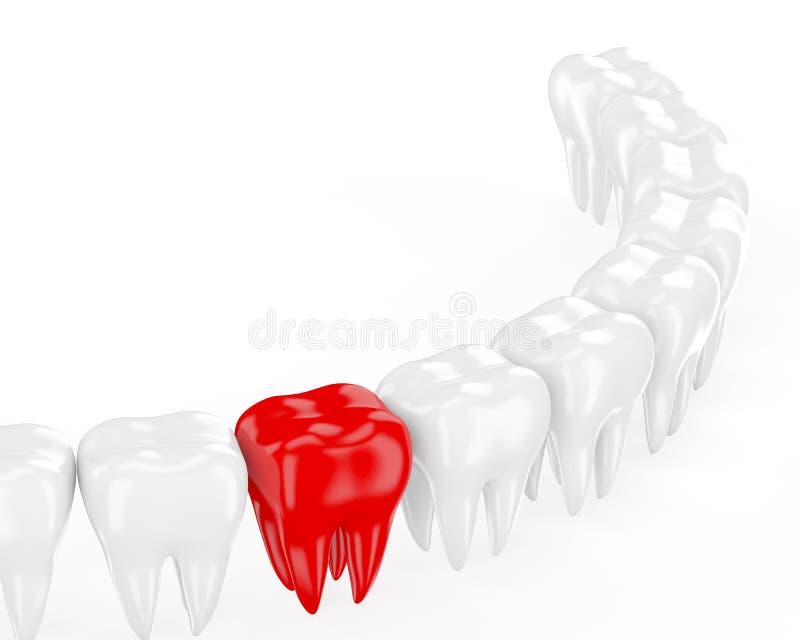 Aching Tooth in Row of Healthy Teeth Stock Illustration - Illustration ...