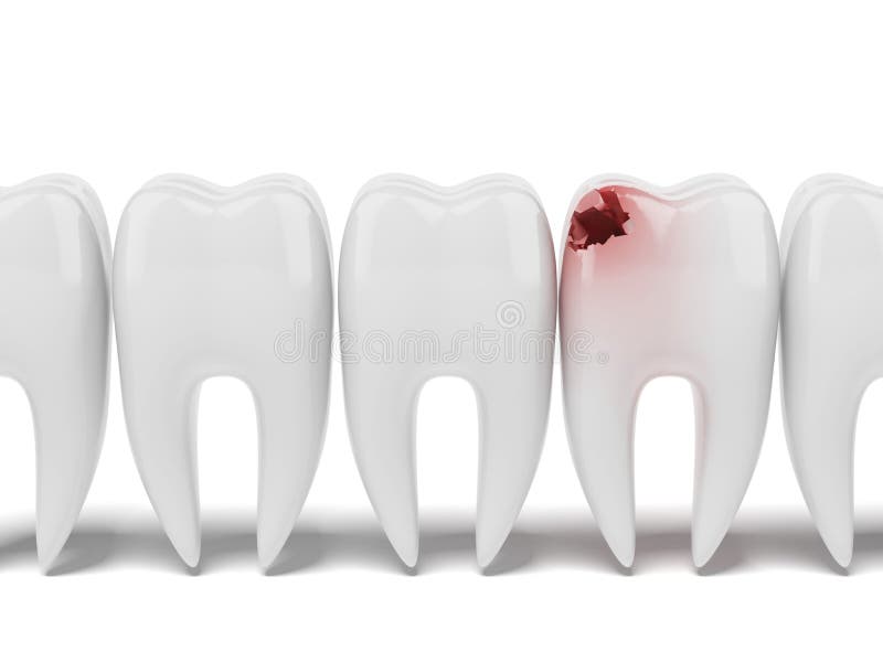 Row Teeth Stock Illustrations – 853 Row Teeth Stock Illustrations ...