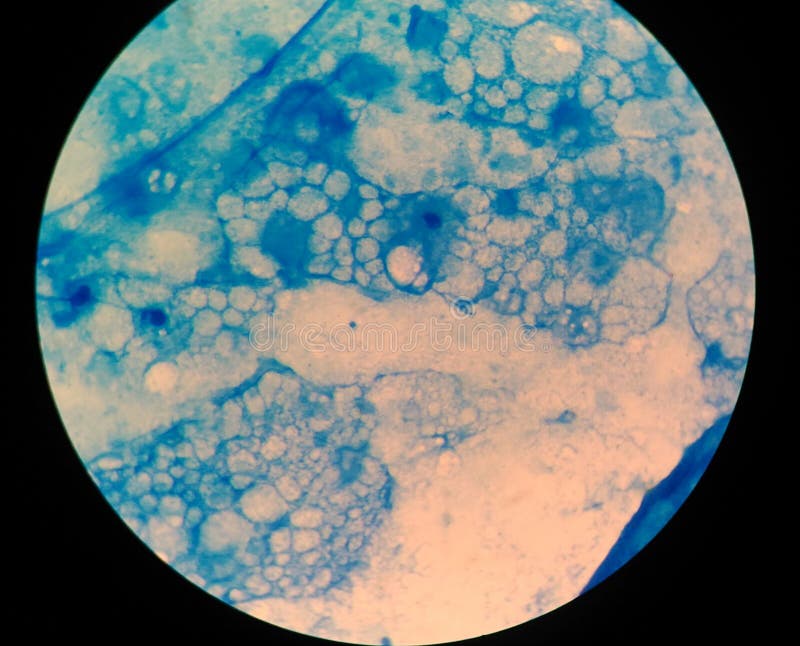 Acid Fast Bacilli Negative on Blue. Stock Photo - Image of mucosa, pits ...