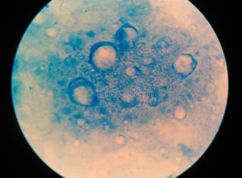 Acid Fast Bacilli Negative on Blue. Stock Photo - Image of microscopy ...