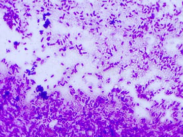 Acinetobacter baumannii stock image. Image of horizontal - 351328705