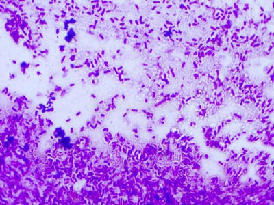 Acinetobacter baumannii stock image. Image of horizontal - 351328705