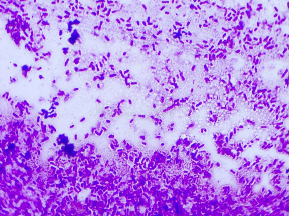 Acinetobacter baumannii stock image. Image of horizontal - 351328705