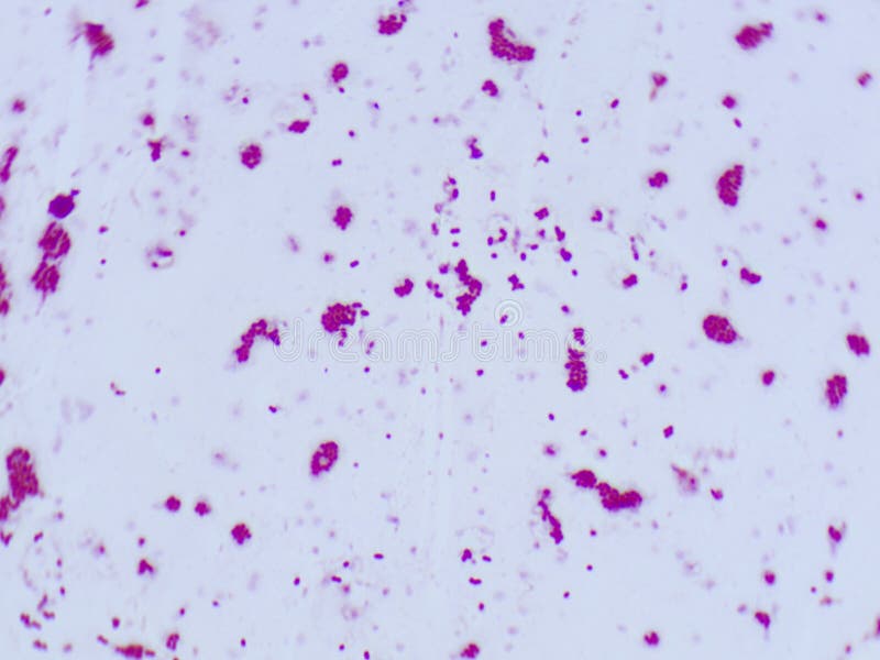 Acinetobacter baumannii stock photo. Image of biotechnology - 351329560