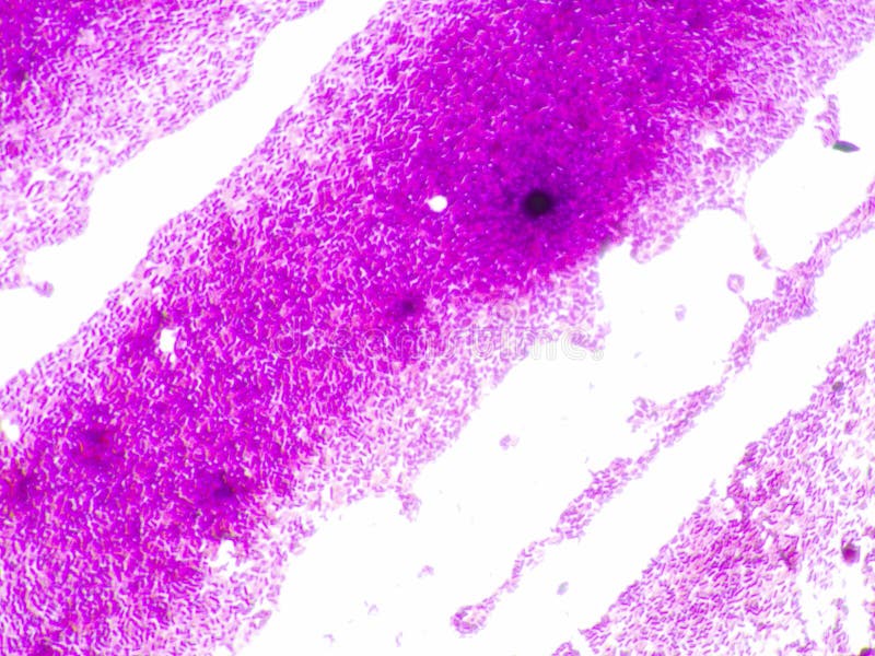 Acinetobacter baumannii stock image. Image of risk, microscope - 351319213