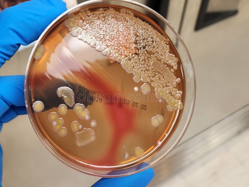 Acinetobacter Hemolytic Bacterial Colonies on Agar Plate Stock Image ...