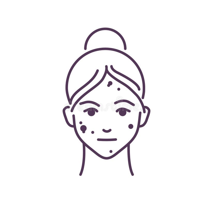 Acne Skin Line Color Icon. Sign for Web Page, Mobile App Stock ... Acne Skin Line Color Icon. Sign for Web Page, Mobile App Stock ...
