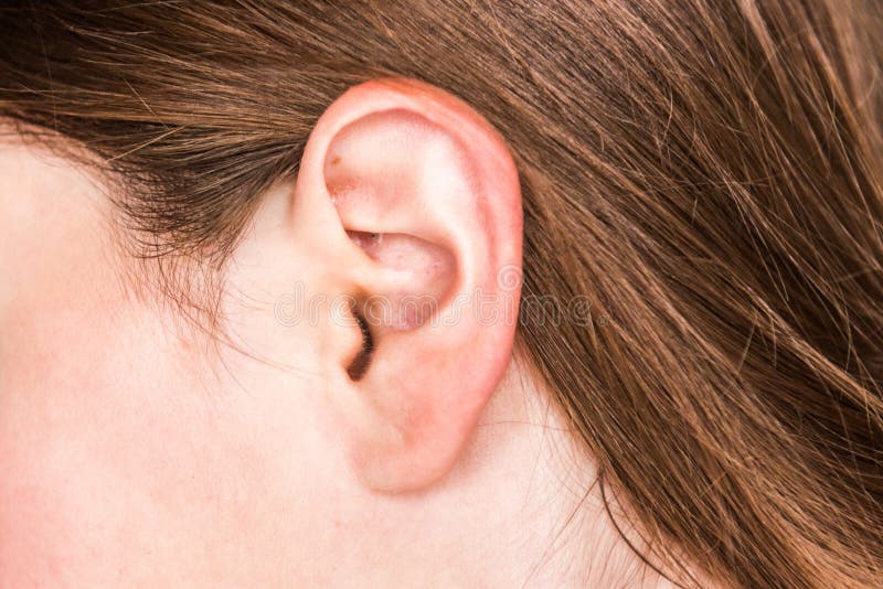 Acne inside the female ear stock image. Image of sound - 195077575