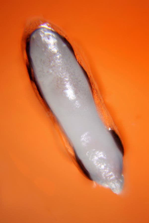 Acne Sedum Plug 200X stock photo. Image of acne, plug - 13533876