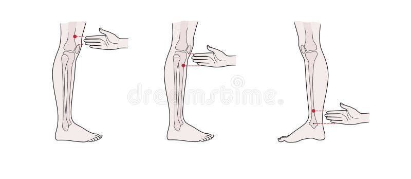 Active Acupuncture Points on the Legs: Above the Knee, Below the Knee ...