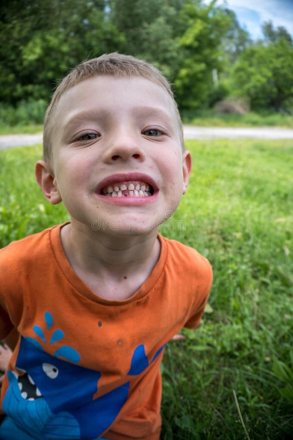 Small Child Lost the First Tooth Stock Image - Image of headphones ...