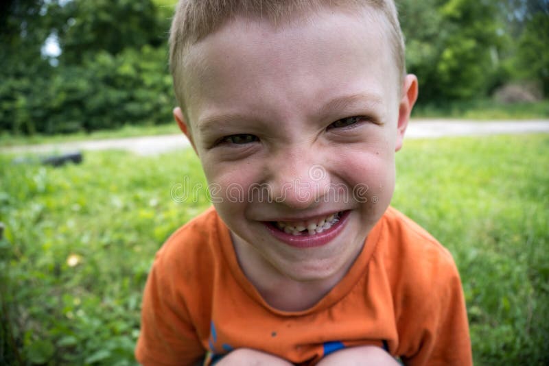 Small Child Lost the First Tooth Stock Photo - Image of combat, hand ...