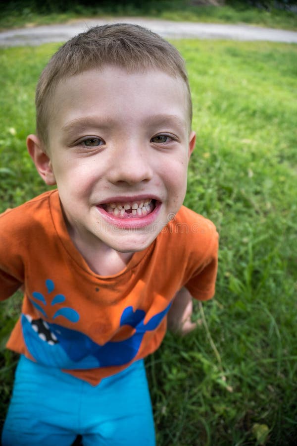 Small Child Lost the First Tooth Stock Photo - Image of floor, defense ...