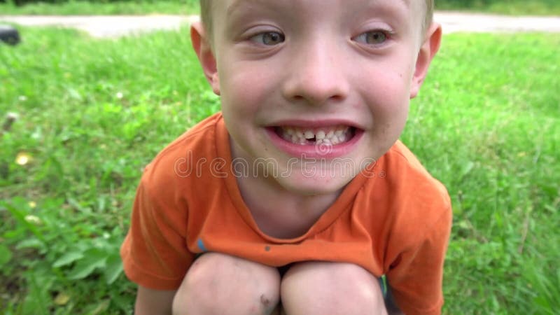 Small Child Lost the First Tooth Stock Video - Video of backyard, face ...
