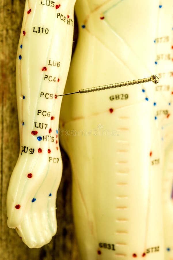 Acupuncture Demonstration on Hand Model Stock Photo - Image of teaching ...