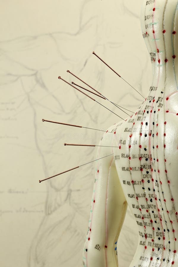 Acupuncture model stock image. Image of learn, needle - 102818643