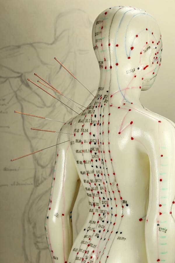 Acupuncture model stock image. Image of pain, practitioners - 102819069