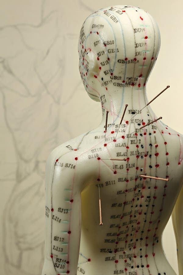 Acupuncture model stock photo. Image of hurt, healthcare - 102819644