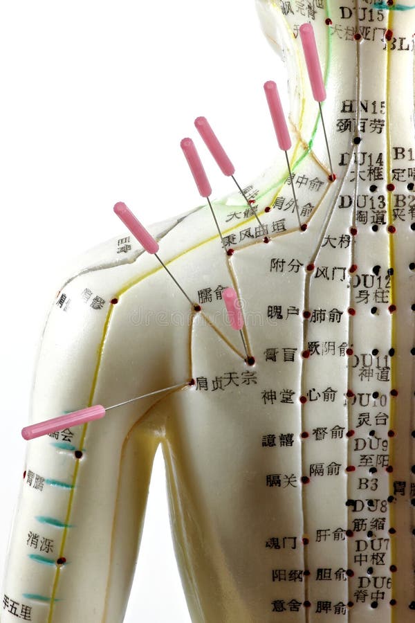 Acupuncture model stock photo. Image of needles, figure - 102822694