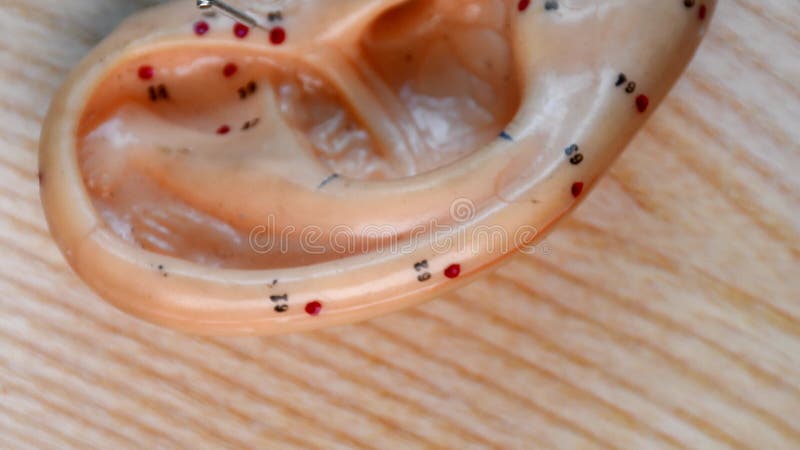 Acupuncture Needle on Acupuncture Model on Turn Table Stock Video ...