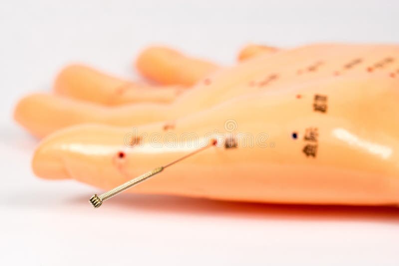Acupuncture Needle on Acupuncture Hand Model Stock Image - Image of ...