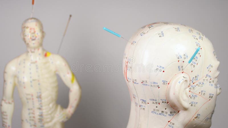 Acupuncture Model with Needles in the Head. Stock Photo - Image of ...
