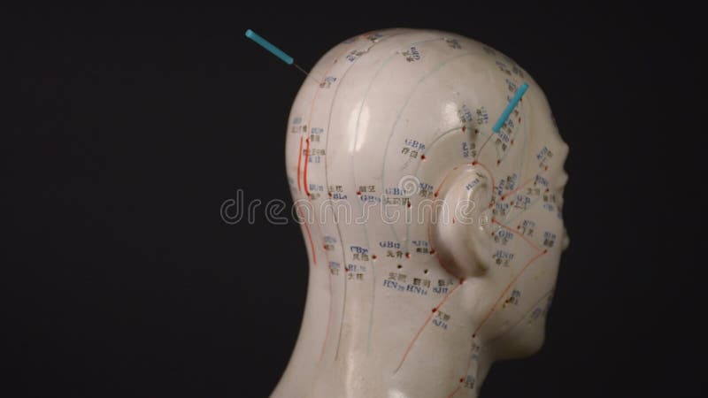 Acupuncture Model with Needles in the Head. Stock Photo - Image of ...