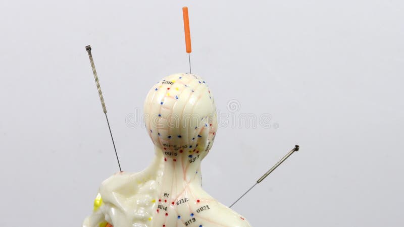 Acupuncture Needles on Acupuncture Model Stock Video - Video of studio ...
