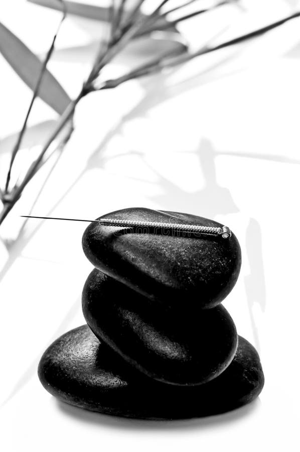Acupuncture needles stock photo. Image of cultural, chinese - 35234936