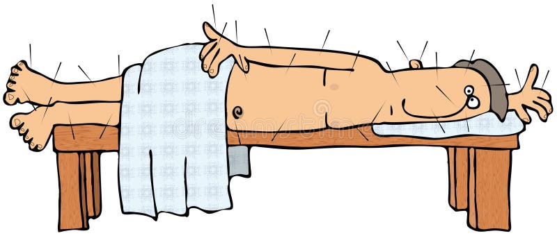 Acupuncture Cartoon Stock Illustrations – 697 Acupuncture Cartoon Stock ...
