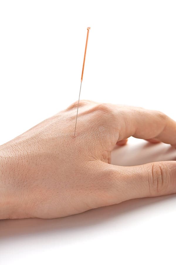 Acupunctured Stock Photos - Free & Royalty-Free Stock Photos from ...