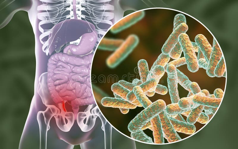 Bacteria Bacteroides Fragilis, The Major Component Of Normal Microbiome ...