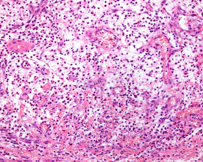 There Blood Vessels Bottom Feet Stock Photos - Free & Royalty-Free ...