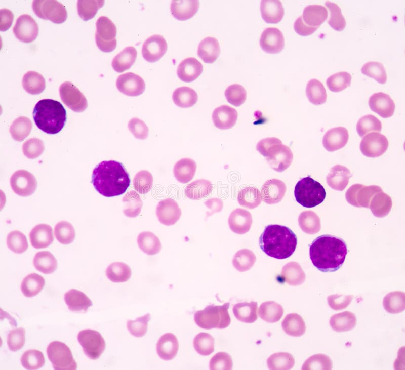 759 Basophil Cell Labeled Stock Photos - Free & Royalty-Free Stock ...