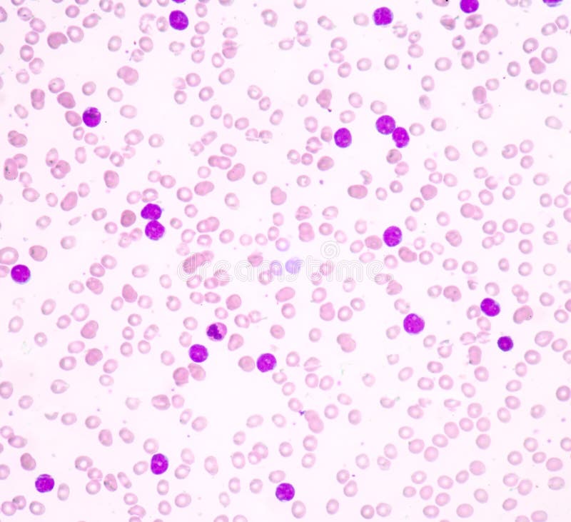 131 Cell Macrocyte Stock Photos - Free & Royalty-Free Stock Photos from ...