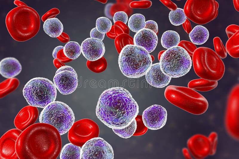 Leukemia Stock Illustrations – 4,407 Leukemia Stock Illustrations ...