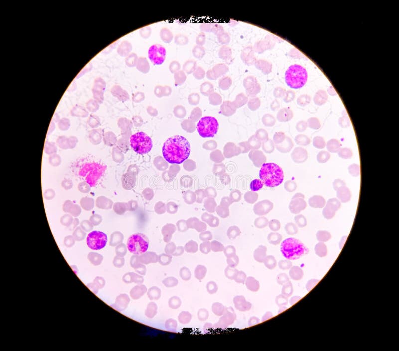 Microscopic Examination of Stained Blood Films Used To Differentiate ... Microscopic Examination of Stained Blood Films Used To Differentiate ...
