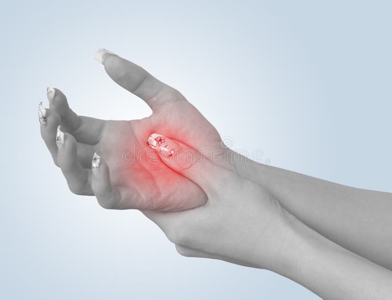 439 Acute Pain Palm Hand Stock Photos - Free & Royalty-Free Stock ...
