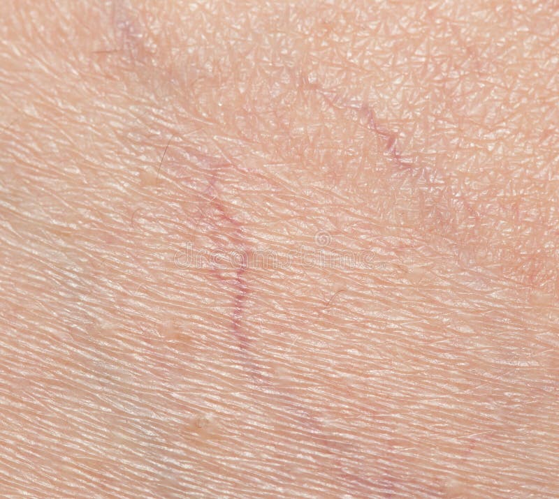 Aders op de huid sluit stock foto. Image of levensstijl - 106835314