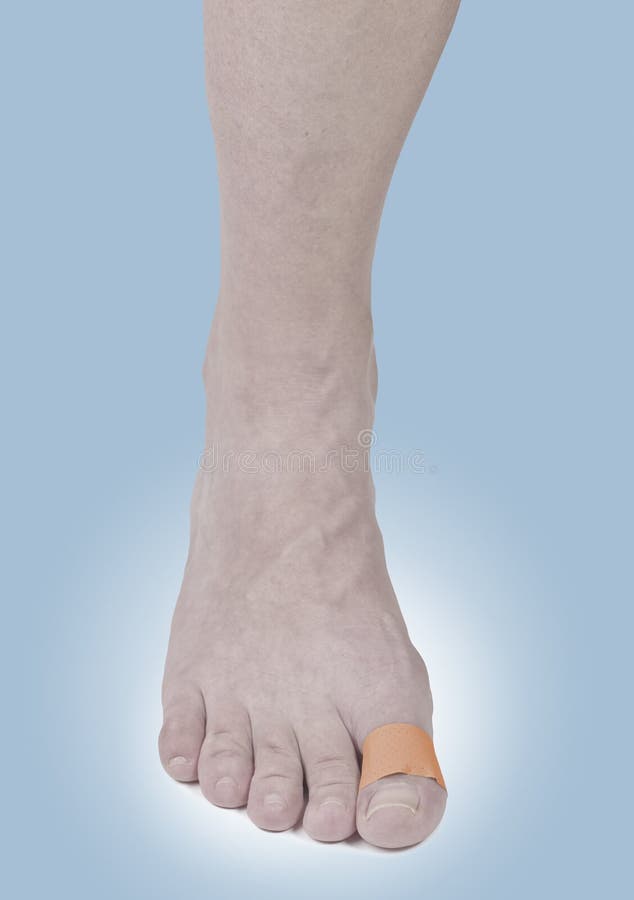 Adhesive Healing Plaster on Foot Finger. Stock Photo - Image of band ...