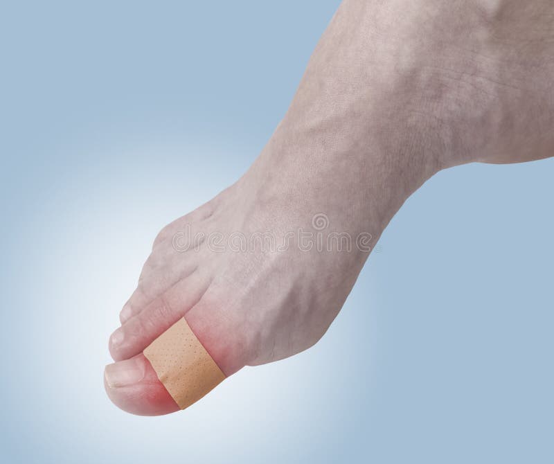 Adhesive Healing Plaster on Foot Finger. Stock Image - Image of band ...