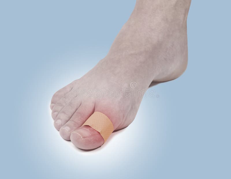 Adhesive Healing Plaster on Foot Finger. Stock Photo - Image of healing ...
