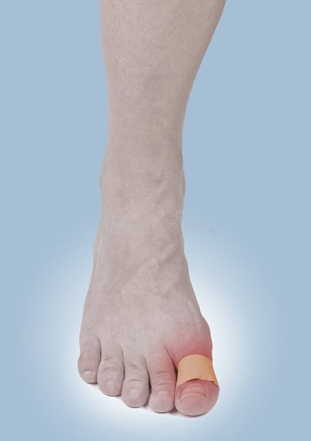 Adhesive Healing Plaster on Foot Finger. Stock Image - Image of band ...