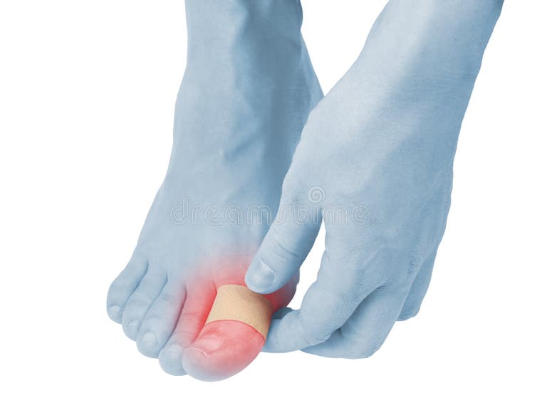 Adhesive Healing Plaster on Foot Finger. Stock Image - Image of cure ...